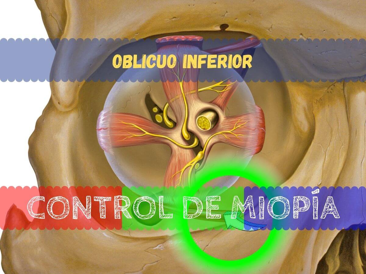 ↘️ Músculo OBLICUO INFERIOR - Control de Miopía | La mejor Información ...