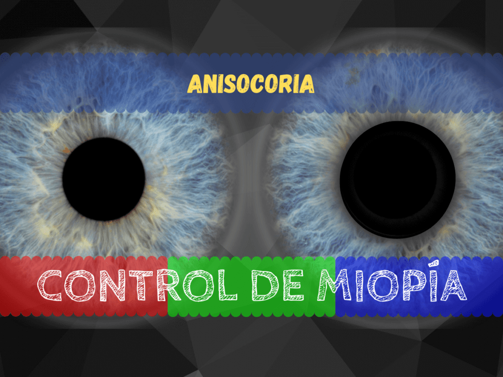 ANISOCORIA -¿Por qué tus 👁️‍🗨️ no son iguales?